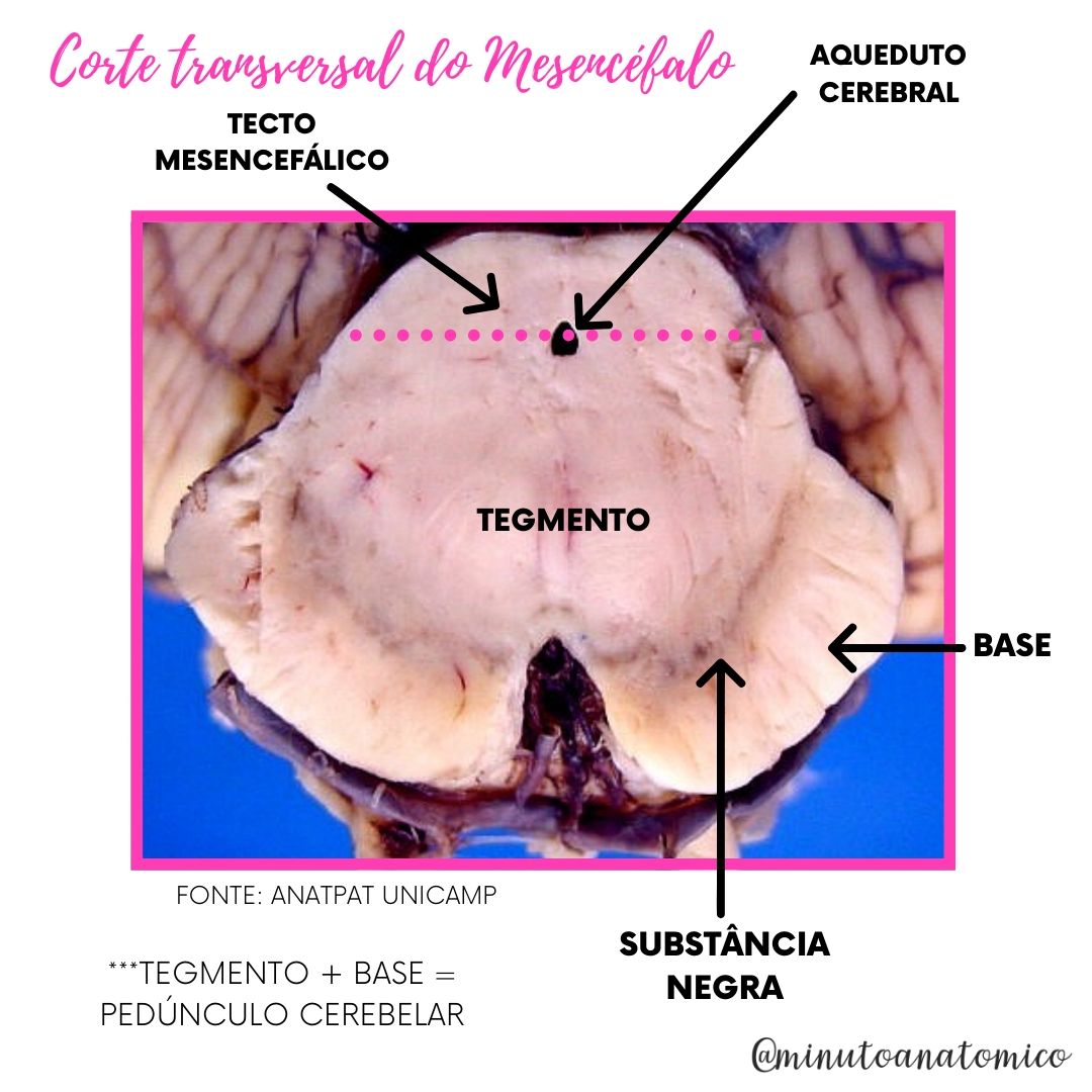 Minuto Anatômico #16: Mesencéfalo – Anatomia & Fisioterapia