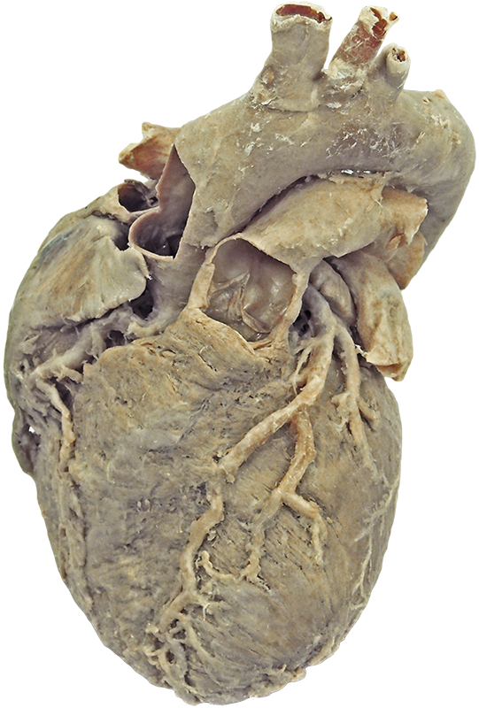 2. Coração – Anatomia & Fisioterapia