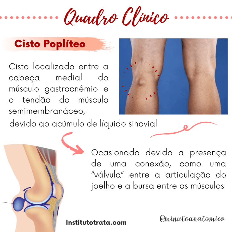 Minuto Anatômico #55: Fossa Poplítea – Anatomia & Fisioterapia