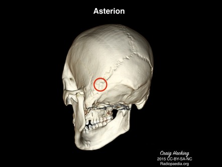 O que é o Astério? – Anatomia & Fisioterapia