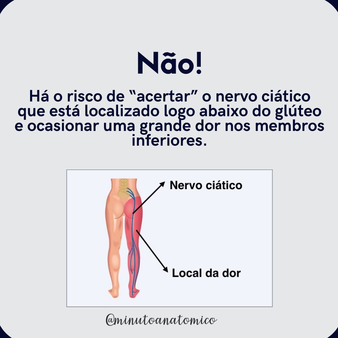 Minuto anatômico #117: Injeção intramuscular no glúteo – Anatomia ...