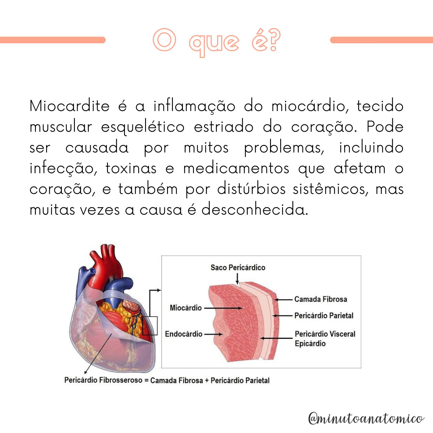 Minuto Anatomoclínico #31: Miocardite – Anatomia & Fisioterapia
