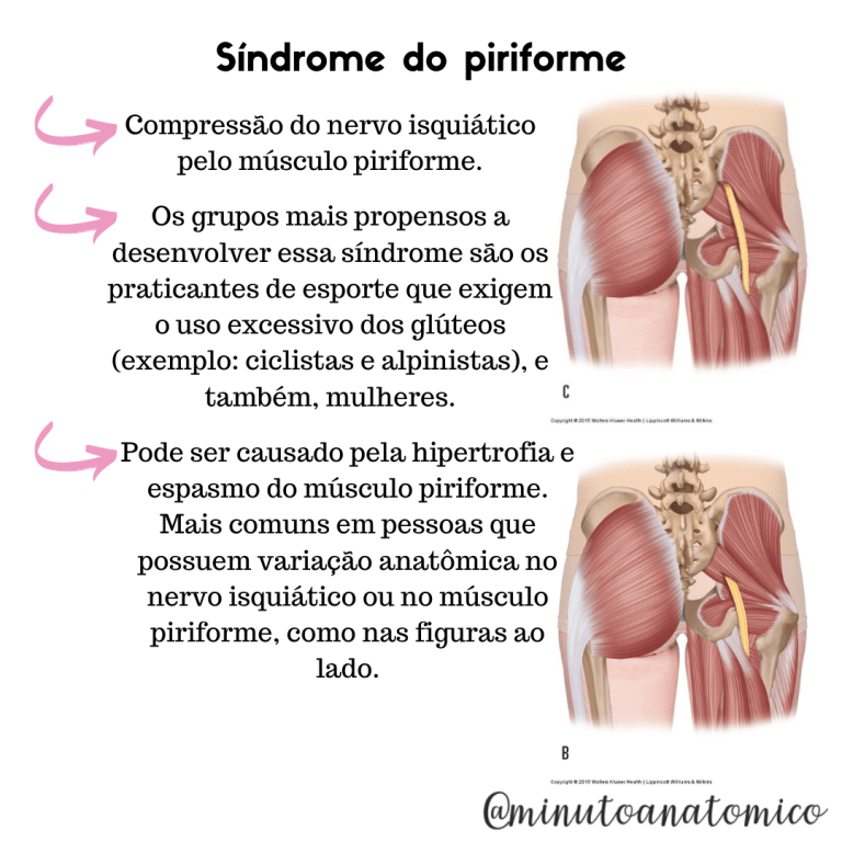 Minuto anatomoclínico #35: Síndrome do Piriforme – Anatomia & Fisioterapia