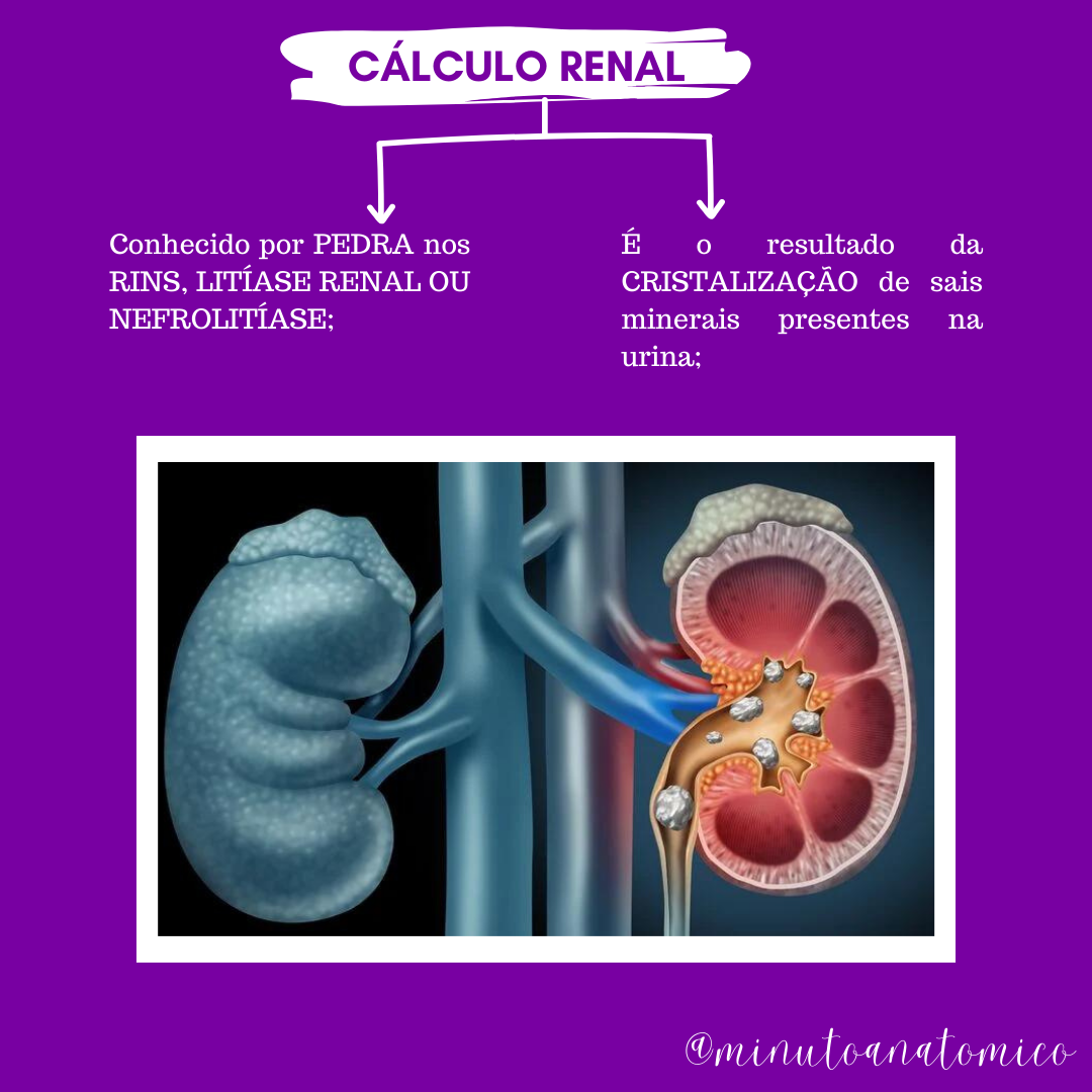Minuto Anatomoclínico #40: Cálculo renal – Anatomia & Fisioterapia
