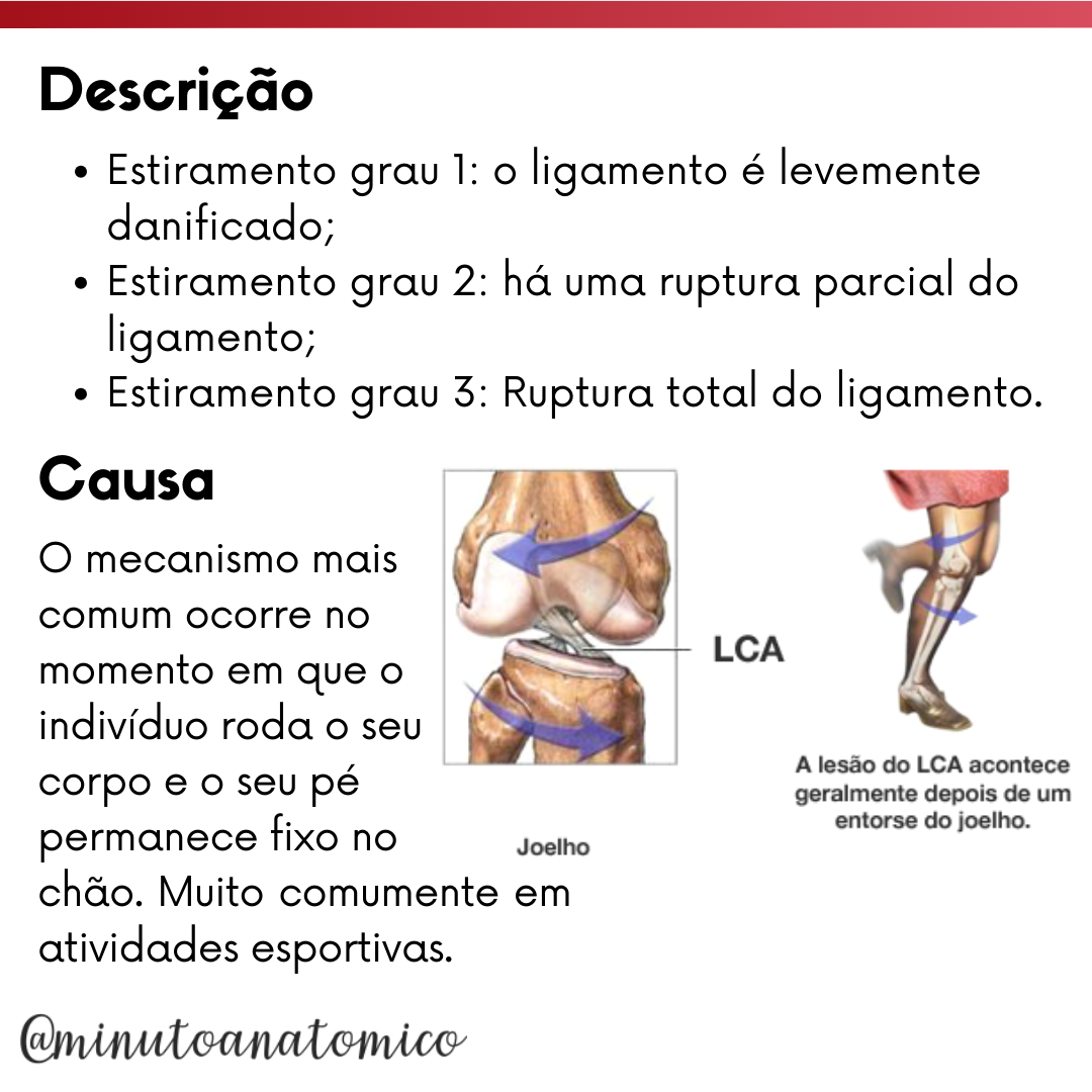 Minuto Anatomoclínico #42: Lesão de LCA – Anatomia & Fisioterapia