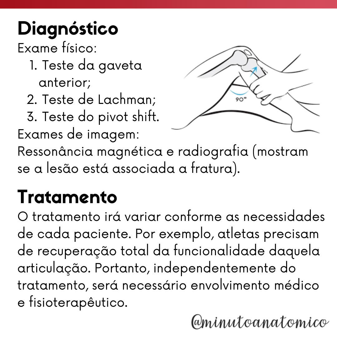 Minuto Anatomoclínico #42: Lesão de LCA – Anatomia & Fisioterapia