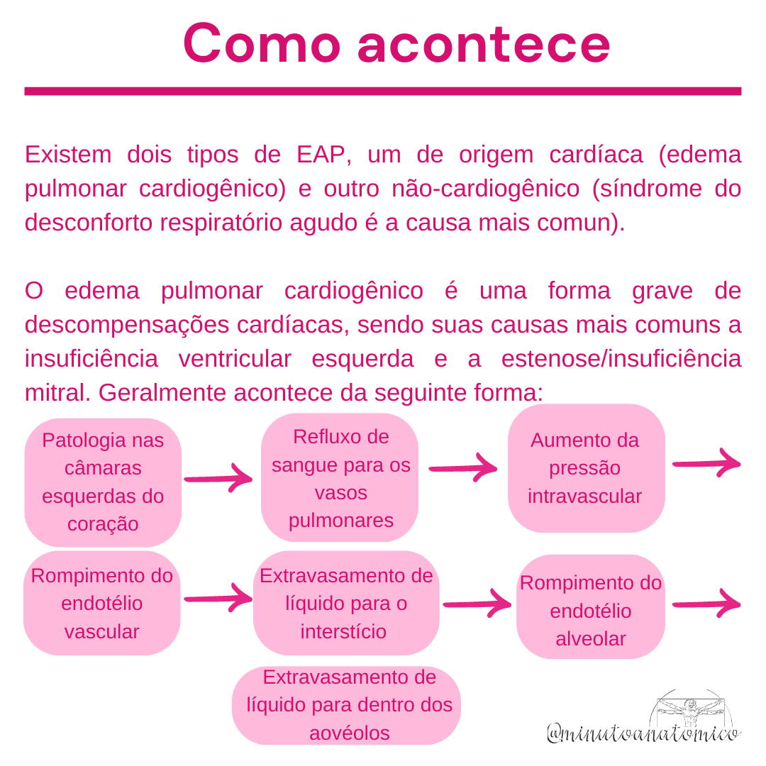 Minuto Anatômico #200: Edema agudo de pulmão cardiogênico – Anatomia ...