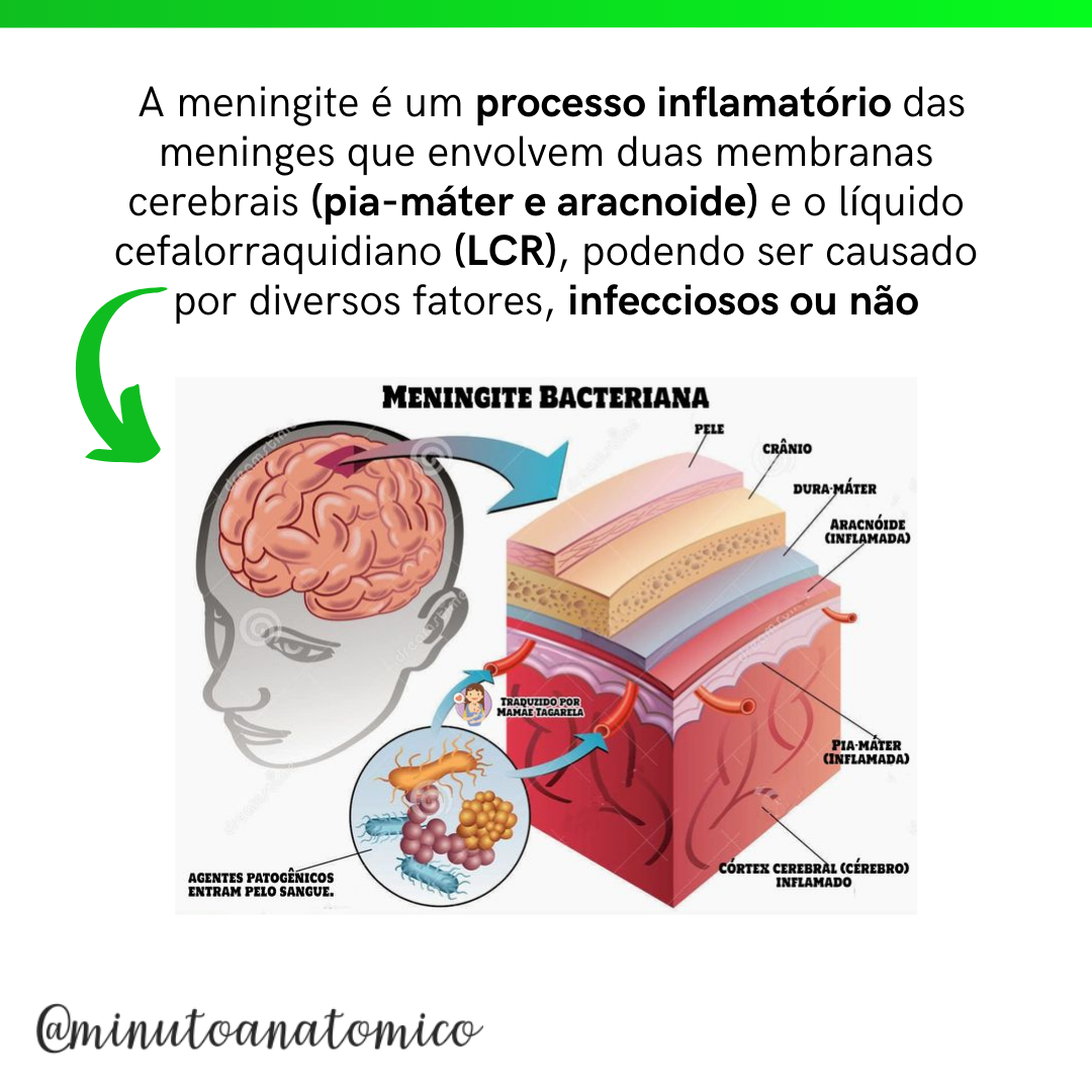 Minuto Anatomoclínico #45: Meningite bacteriana e aplicação ...