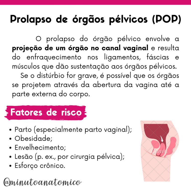 Minuto Anatomoclínico #44: Prolapso de órgãos pélvicos – Anatomia ...