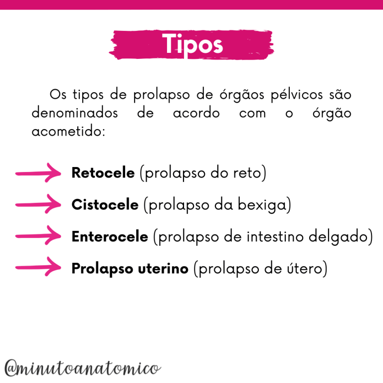 Minuto Anatomoclínico #44: Prolapso de órgãos pélvicos – Anatomia ...