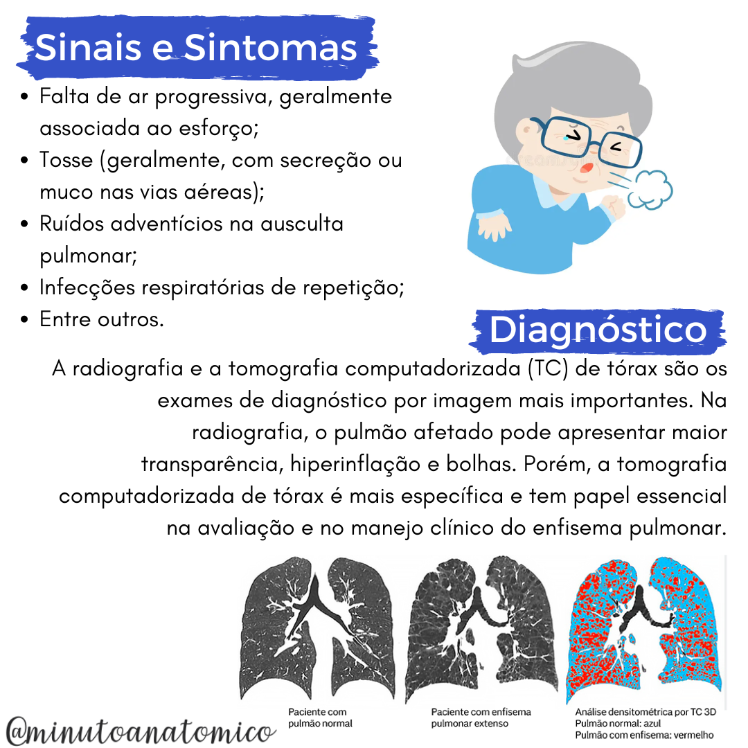 Minuto Anatomoclínico #46: Enfisema pulmonar – Anatomia & Fisioterapia