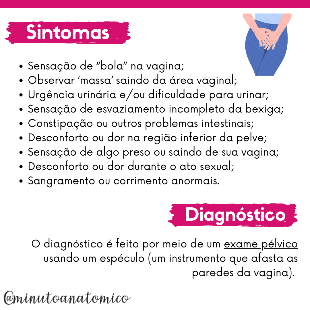 Minuto Anatomoclínico #44: Prolapso de órgãos pélvicos – Anatomia ...