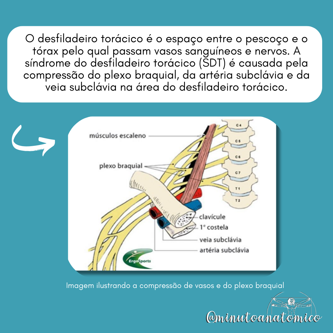 Minuto Anatomoclínico #64: Síndrome do desfiladeiro torácico – Anatomia ...
