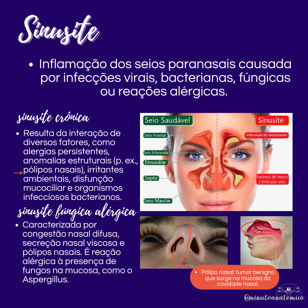 Minuto Anatomoclínico #68: Sinusite – Anatomia & Fisioterapia