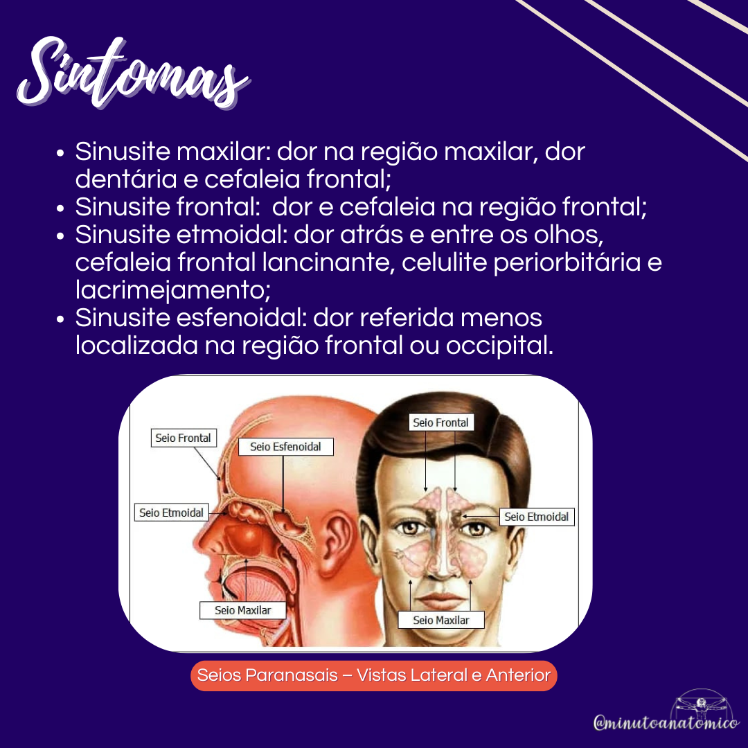 Minuto Anatomoclínico #68: Sinusite – Anatomia & Fisioterapia