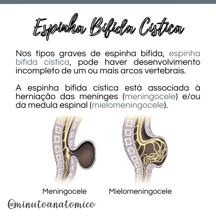 Minuto Anatomoclínico #66: Espinha bífida – Anatomia & Fisioterapia