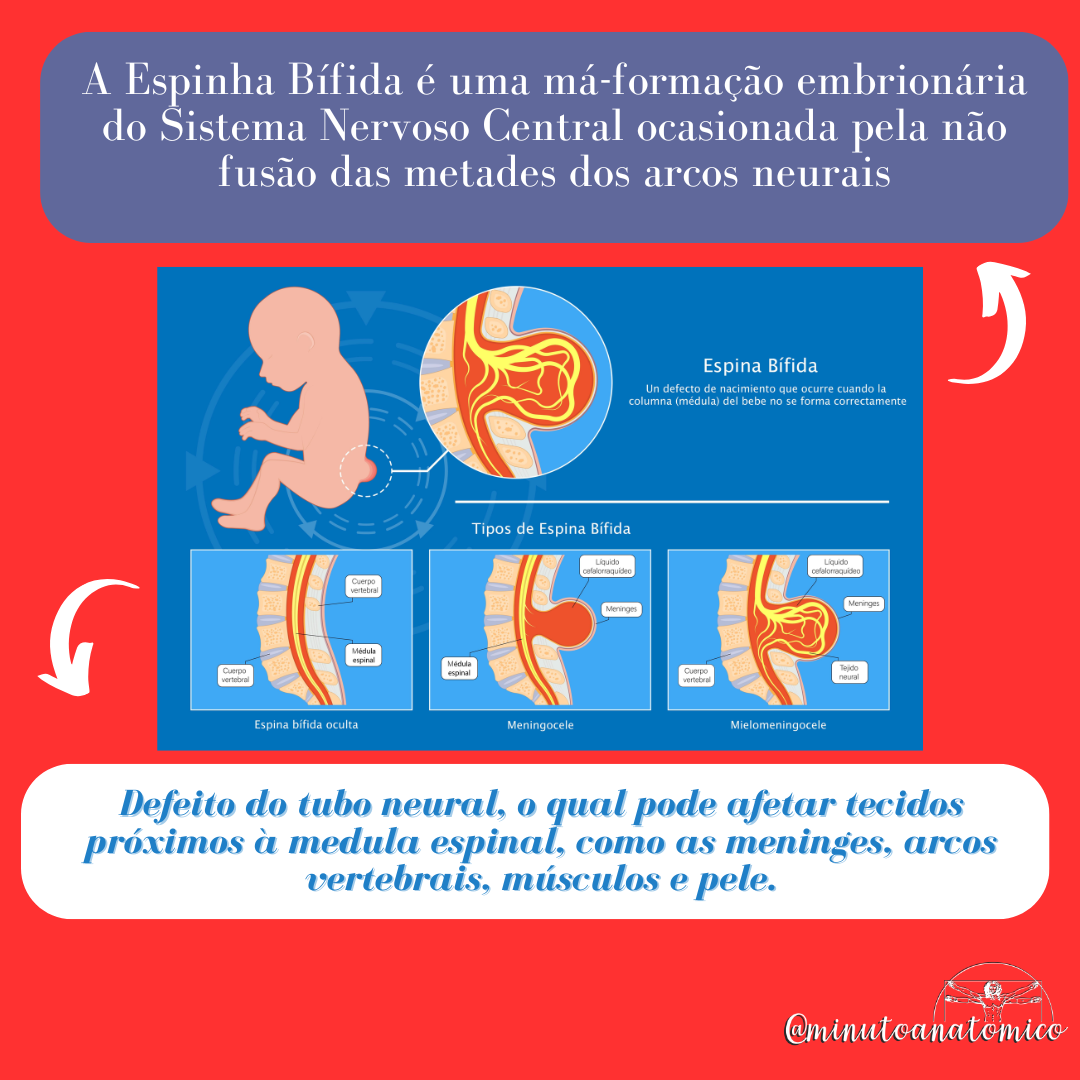 Minuto Anatomoclínico #73: Espinha bífida – Anatomia & Fisioterapia