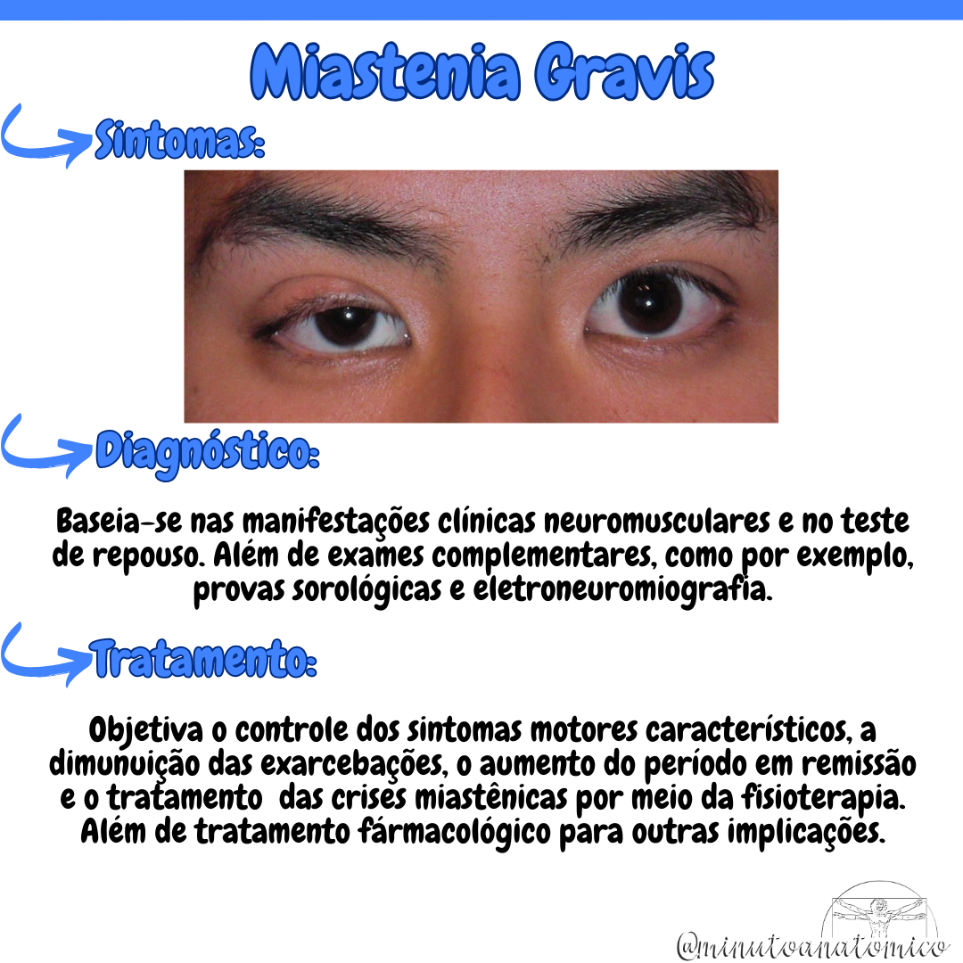 Minuto Anatomoclínico #76: Miastenia Gravis – Anatomia & Fisioterapia