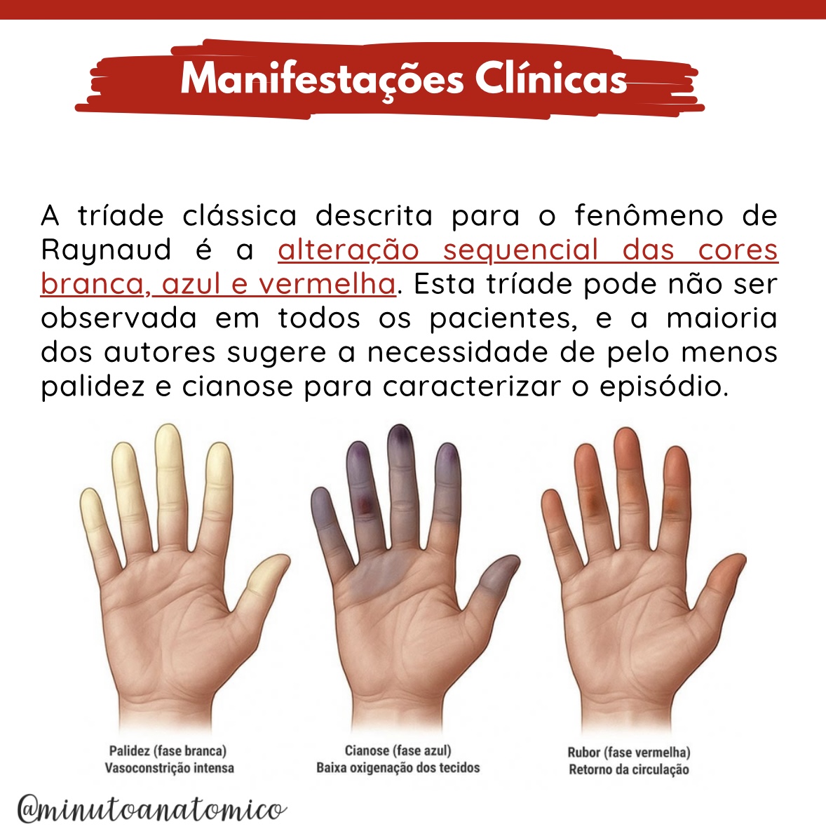 Minuto Anatômico #225: Fenômeno de Raynaud – Anatomia & Fisioterapia