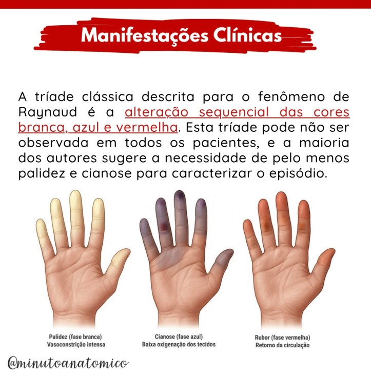 Minuto Anatômico #225: Fenômeno de Raynaud – Anatomia & Fisioterapia