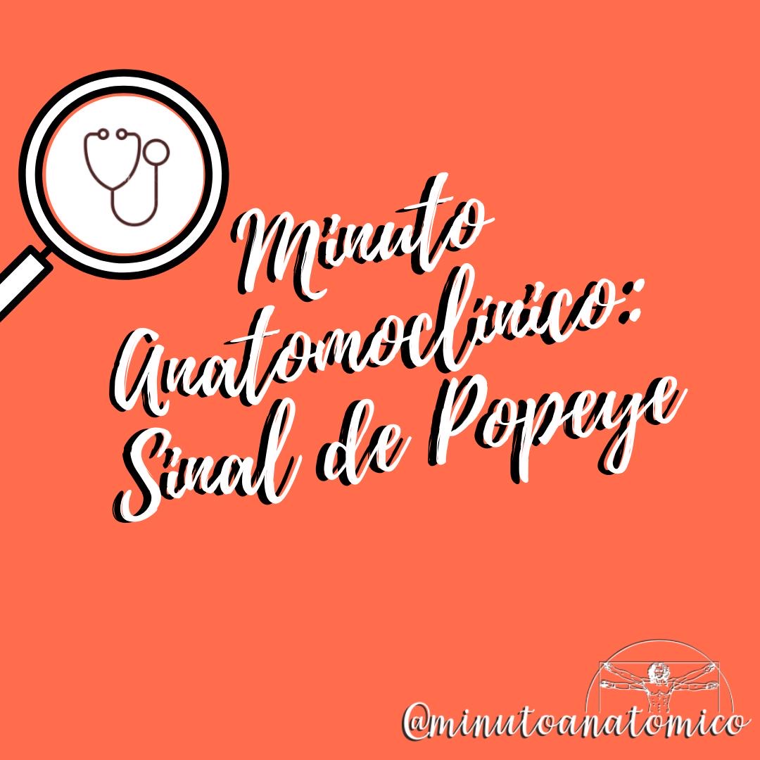 Minuto Anatomoclínico #93: Sinal do Popeye – Anatomia & Fisioterapia