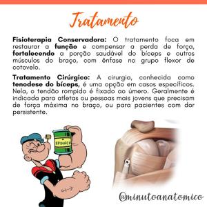 Minuto Anatomoclínico #93: Sinal do Popeye – Anatomia & Fisioterapia